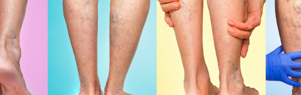 Our Doctor – Reno Vein Clinic